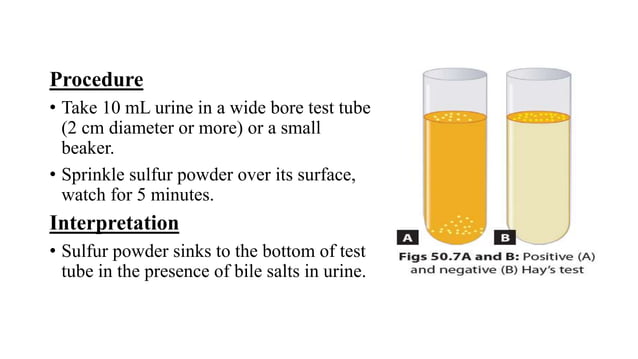 Examination of Urine - Biochemistry and Pathology for Science Students ...