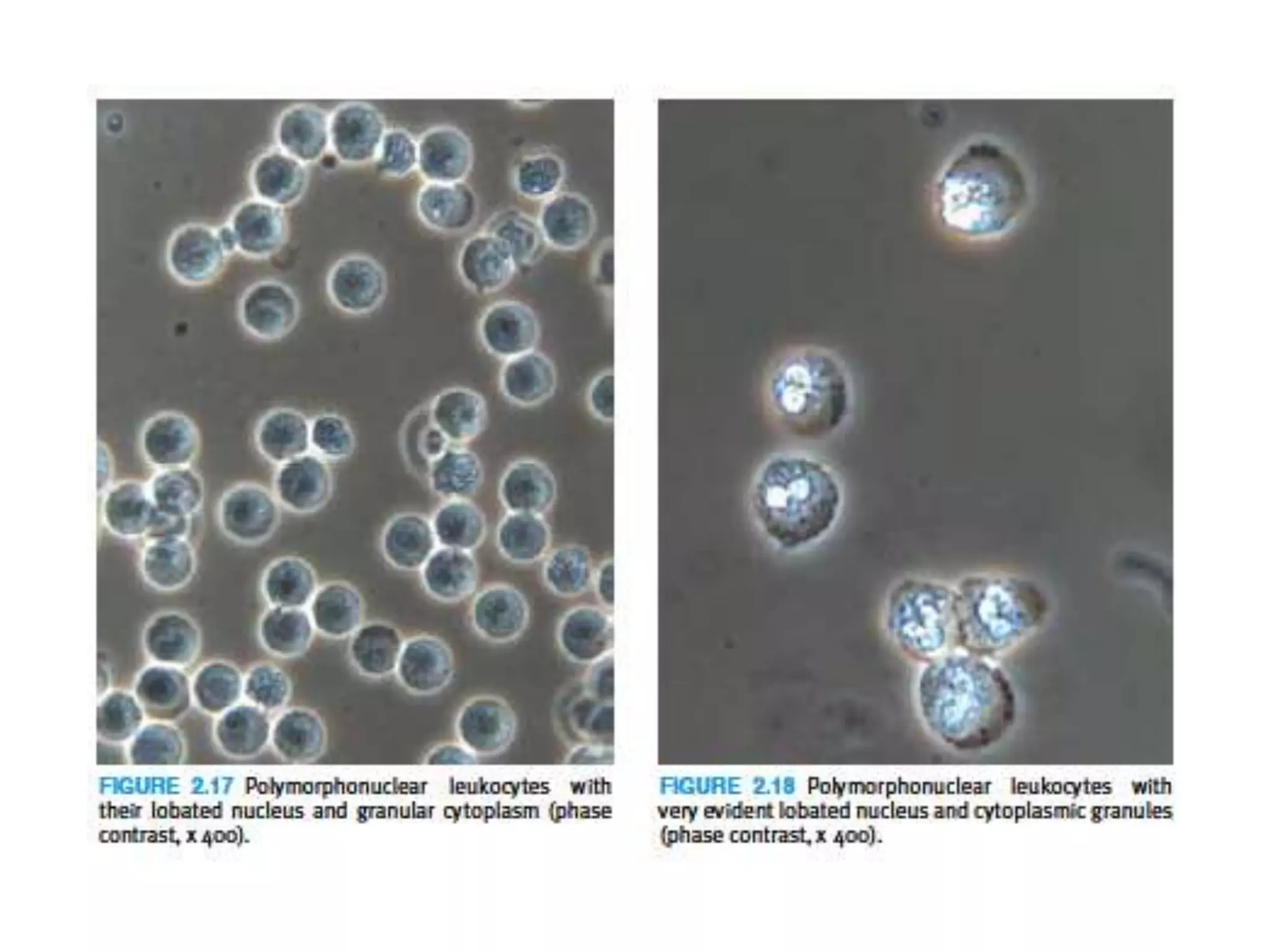 Urine microscopy.ppt