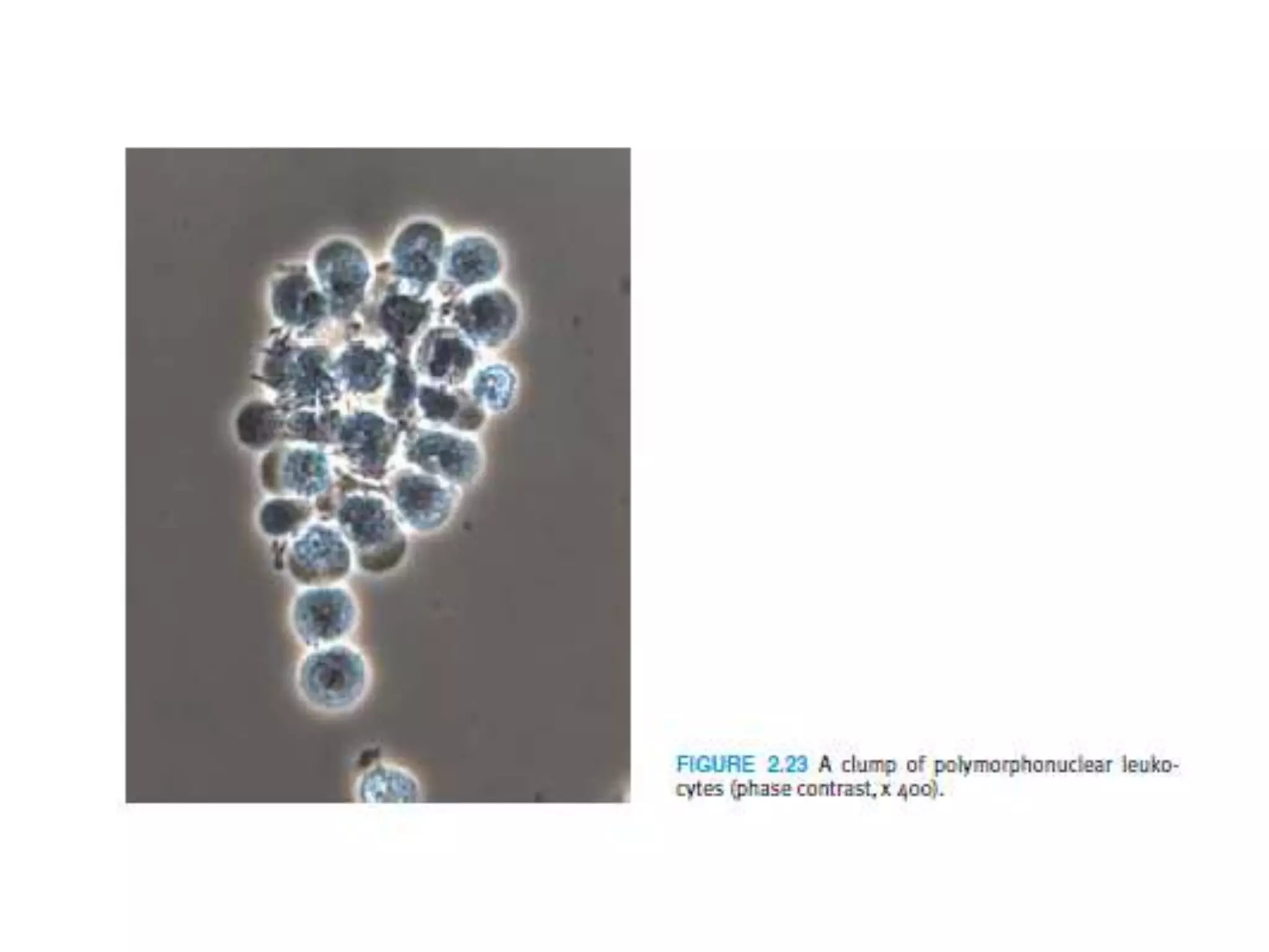 Urine microscopy.ppt