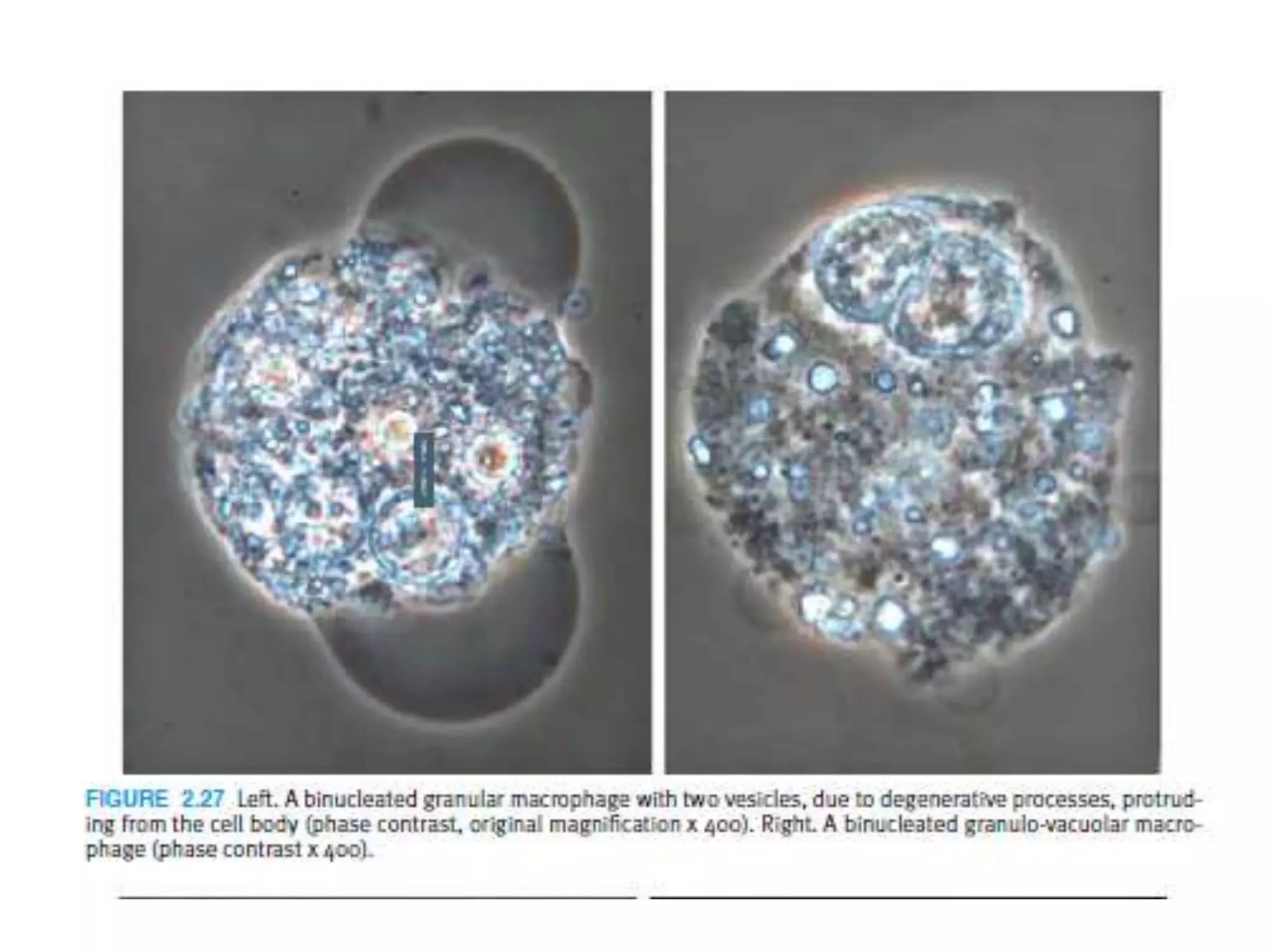 Urine microscopy.ppt