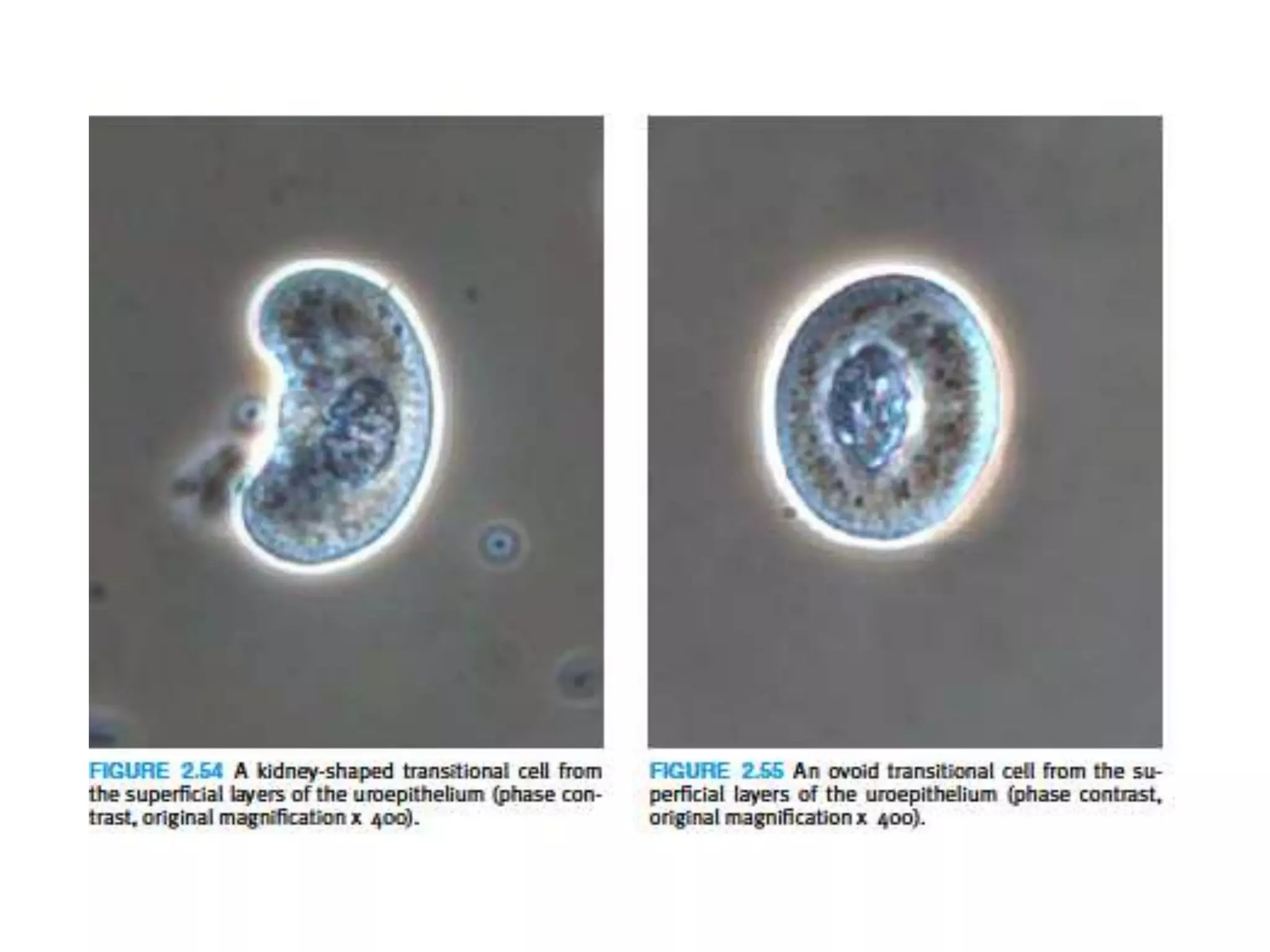 Urine microscopy.ppt