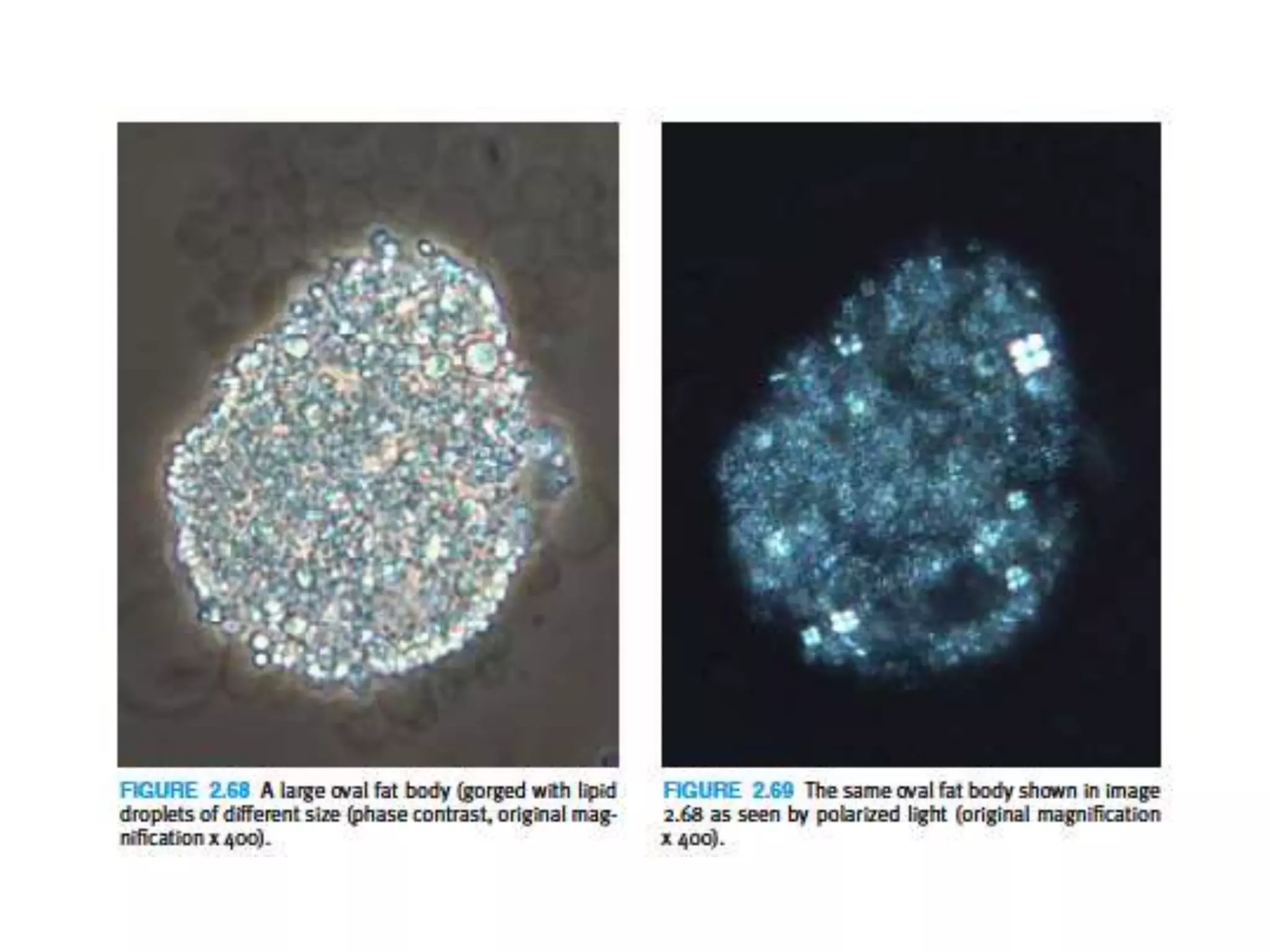 Urine microscopy.ppt