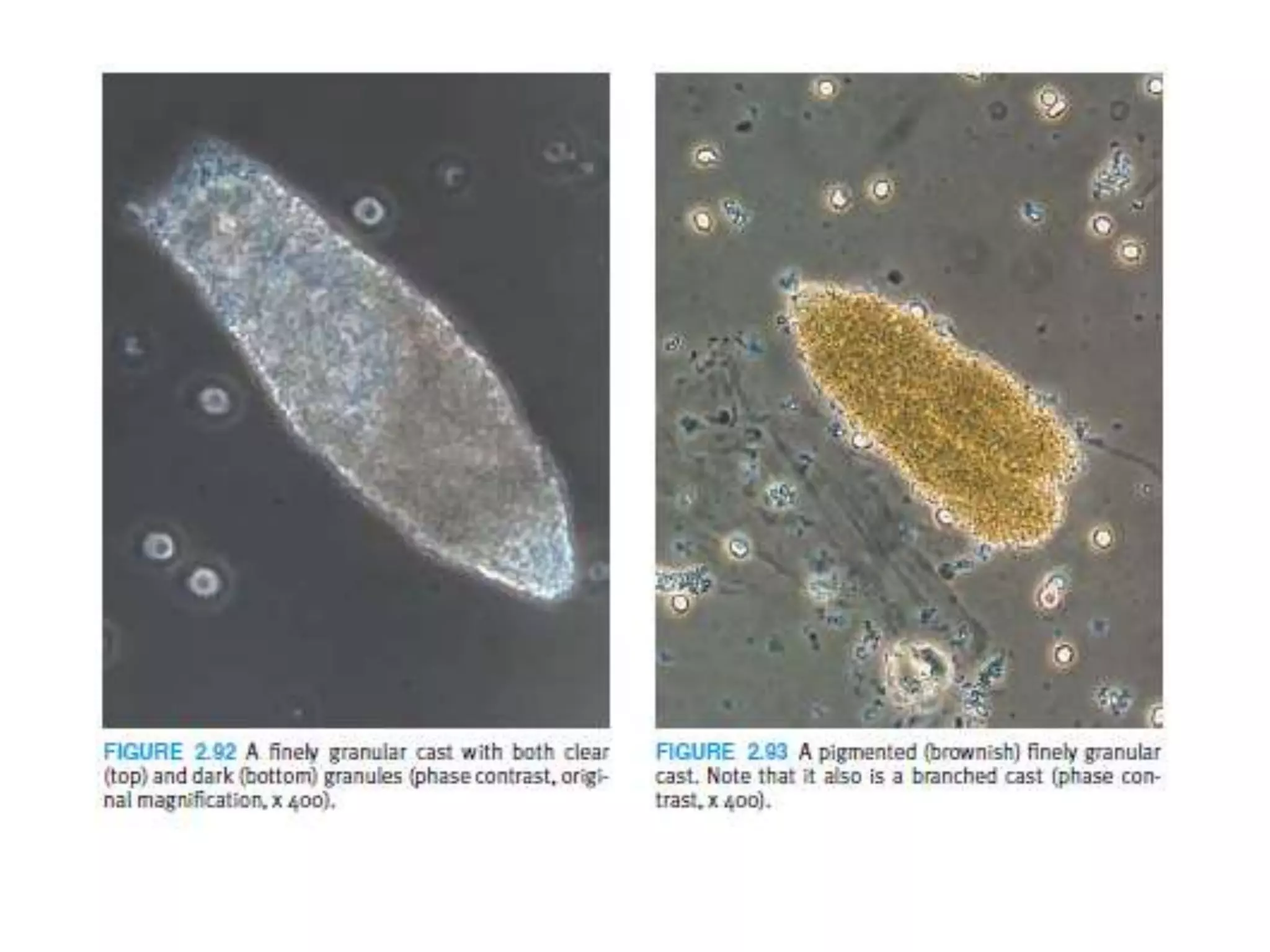 Urine microscopy.ppt