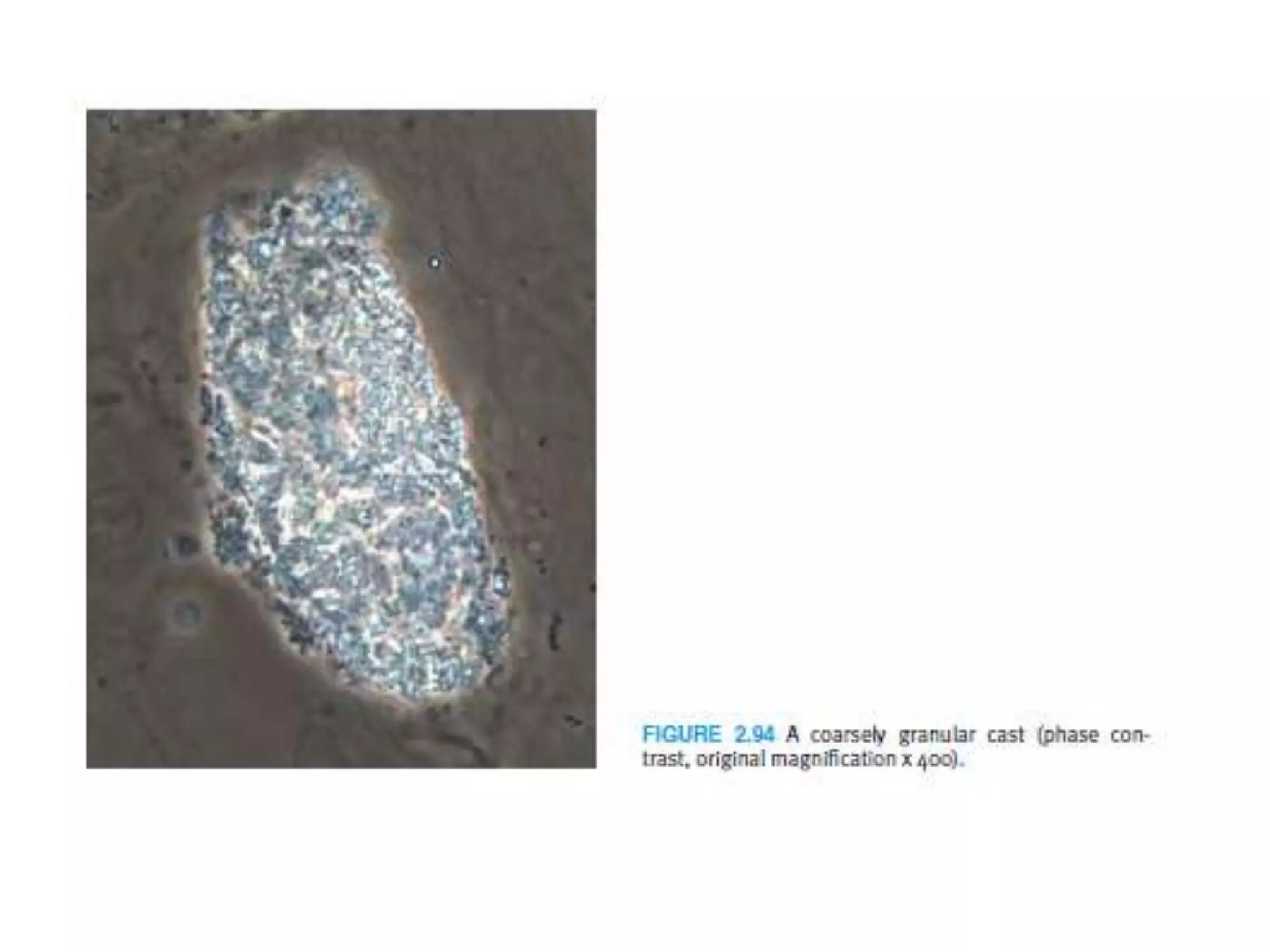 Urine microscopy.ppt