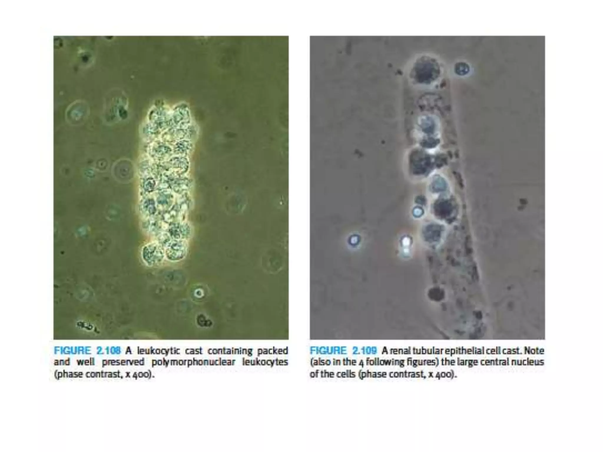 Urine microscopy.ppt