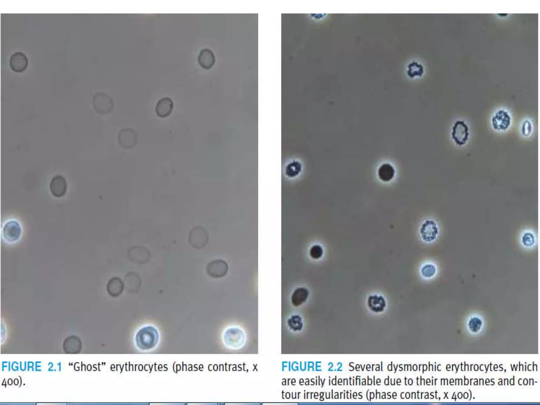 Urine microscopy.ppt