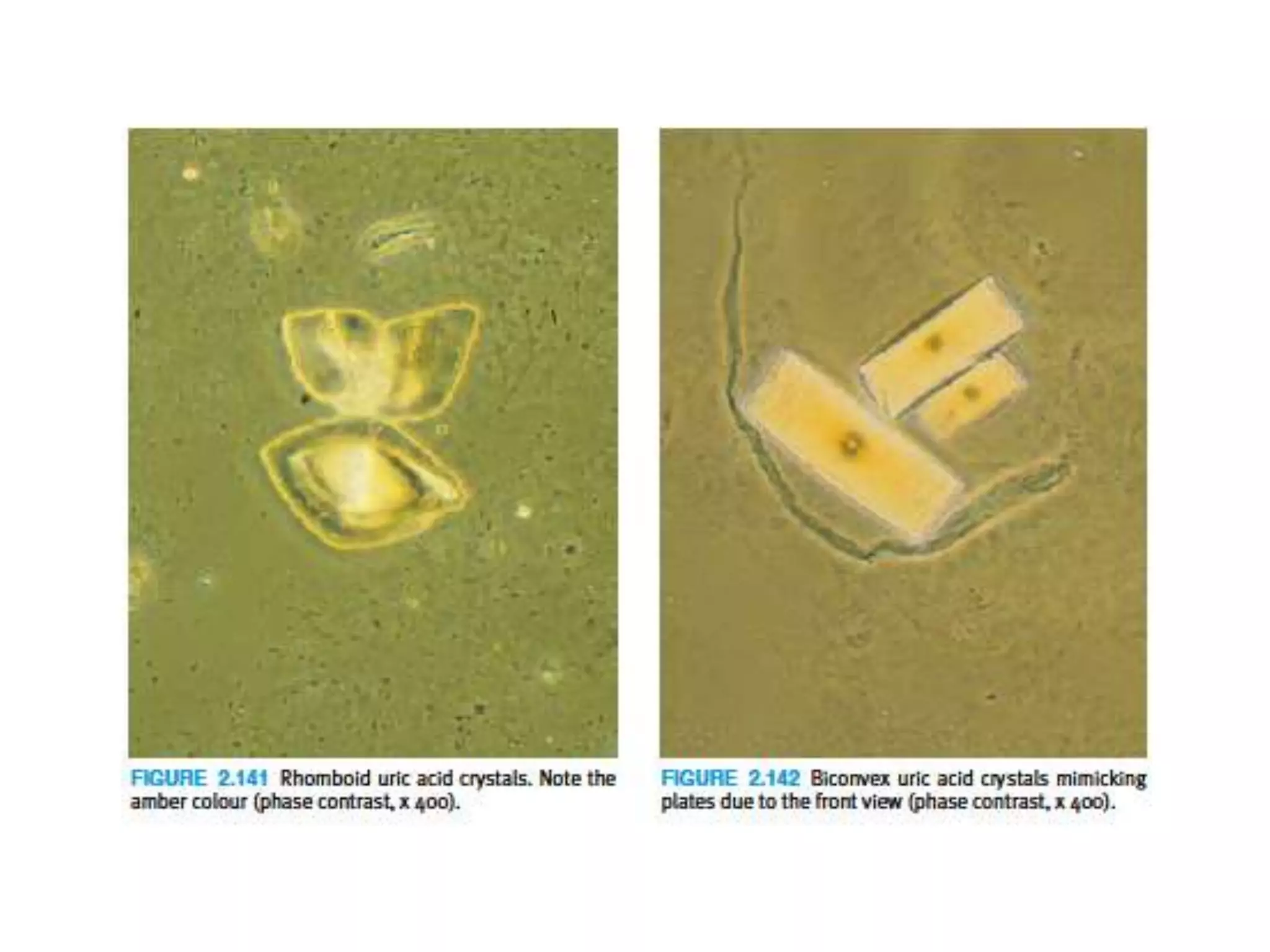 Urine microscopy.ppt