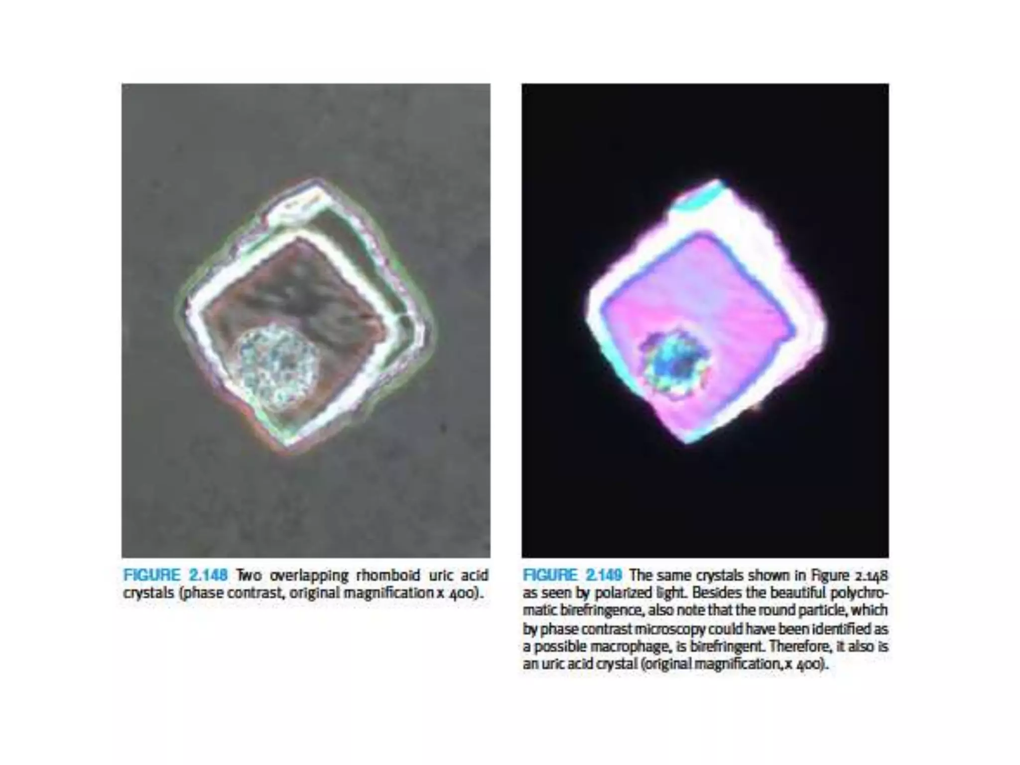 Urine microscopy.ppt