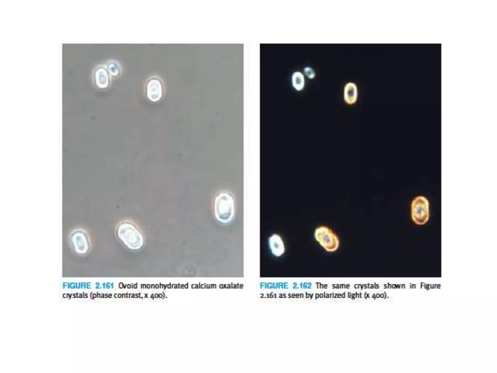 Urine microscopy.ppt