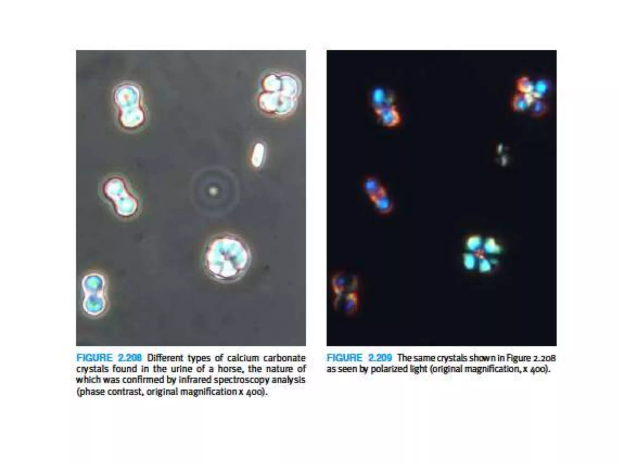 Urine microscopy.ppt