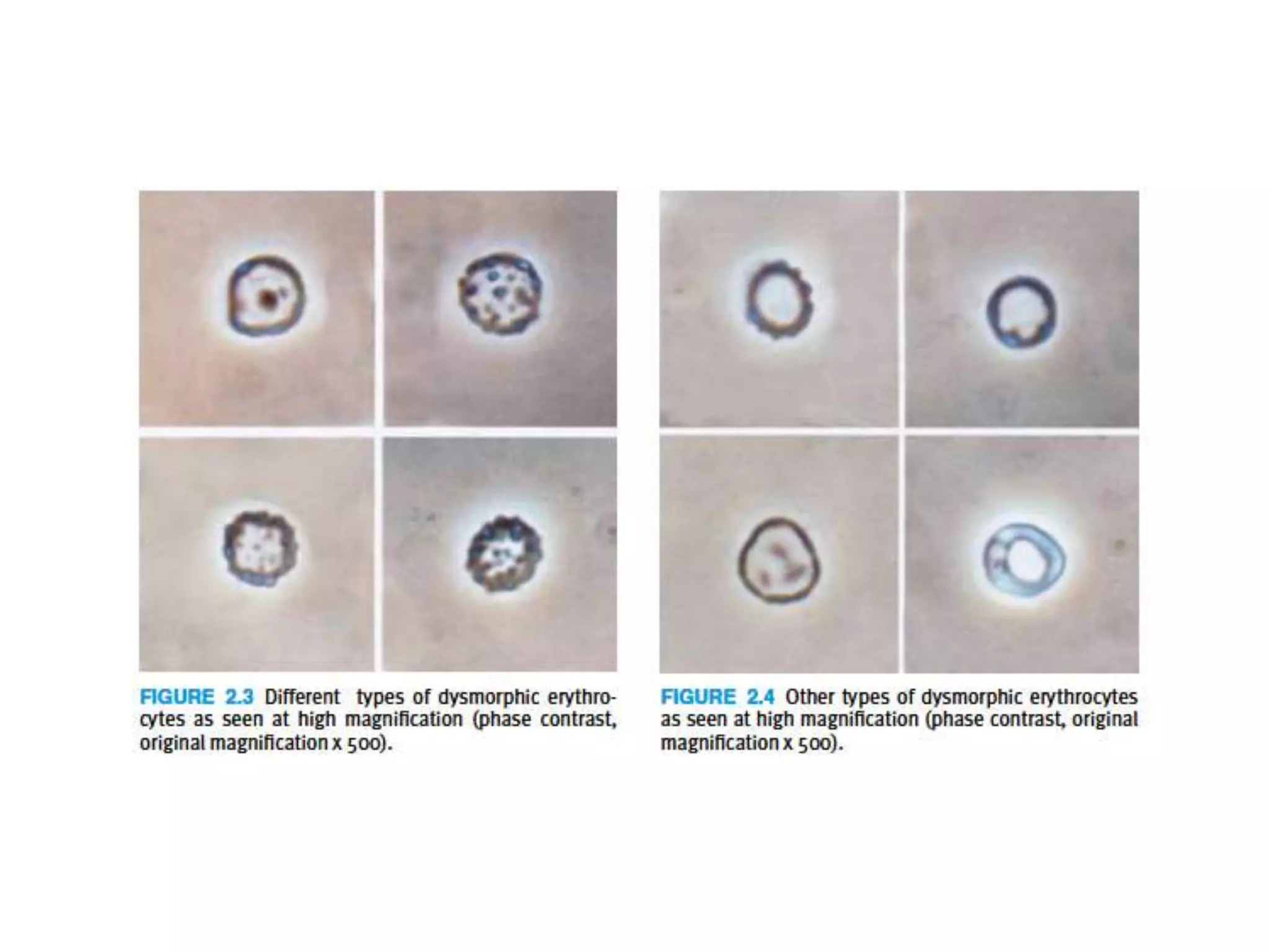 Urine microscopy.ppt