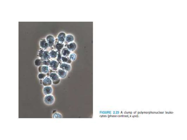 Urine microscopy.ppt