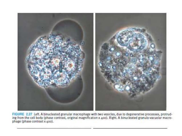 Urine microscopy.ppt