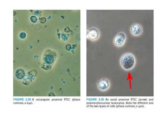 Urine microscopy.ppt