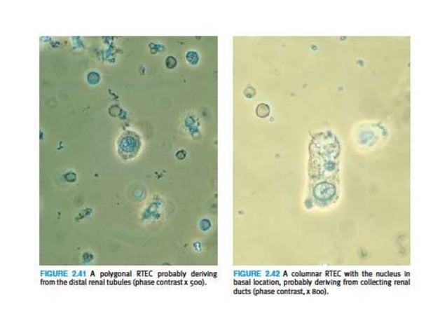Urine microscopy.ppt