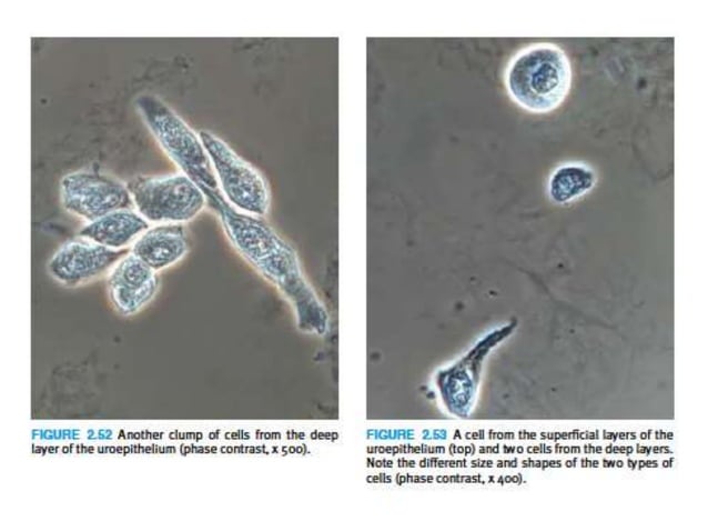 Urine microscopy.ppt