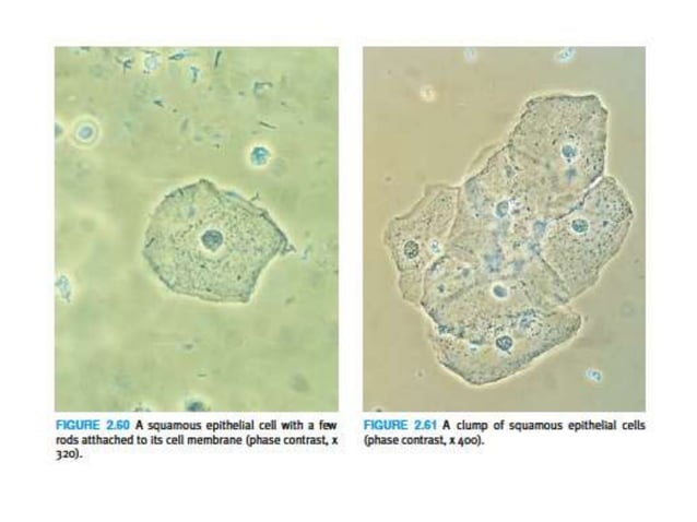 Urine microscopy.ppt