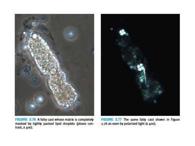 Urine microscopy.ppt