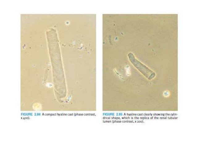 Urine microscopy.ppt