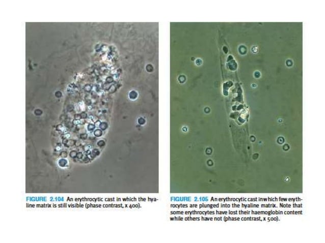 Urine microscopy.ppt