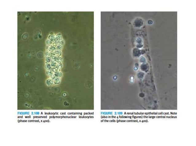 Urine microscopy.ppt