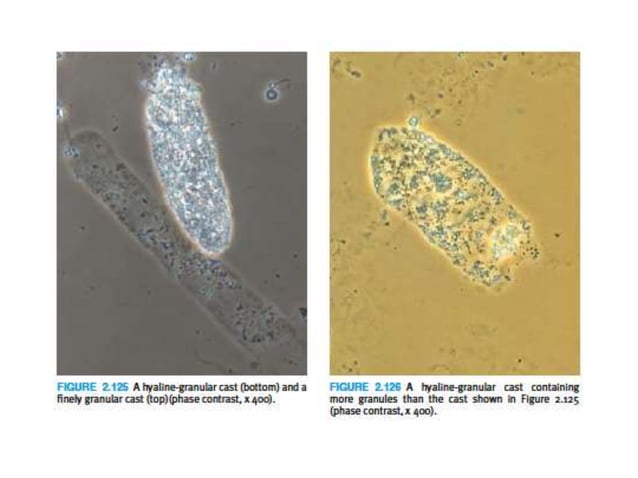 Urine microscopy.ppt