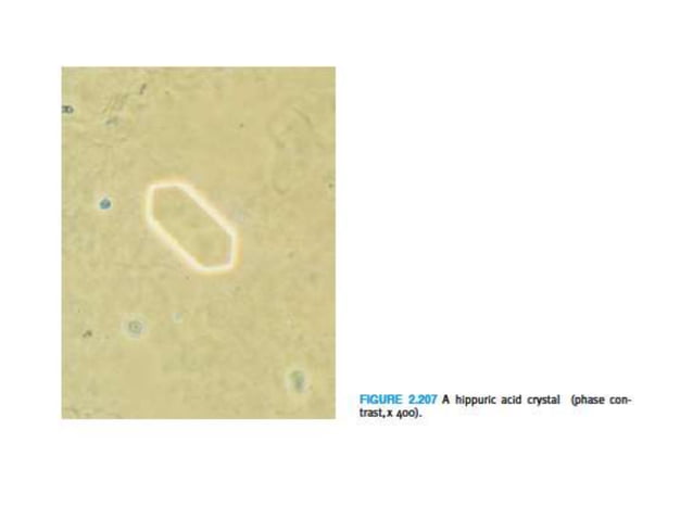Urine microscopy.ppt