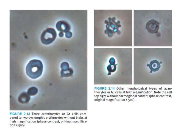 Urine microscopy.ppt