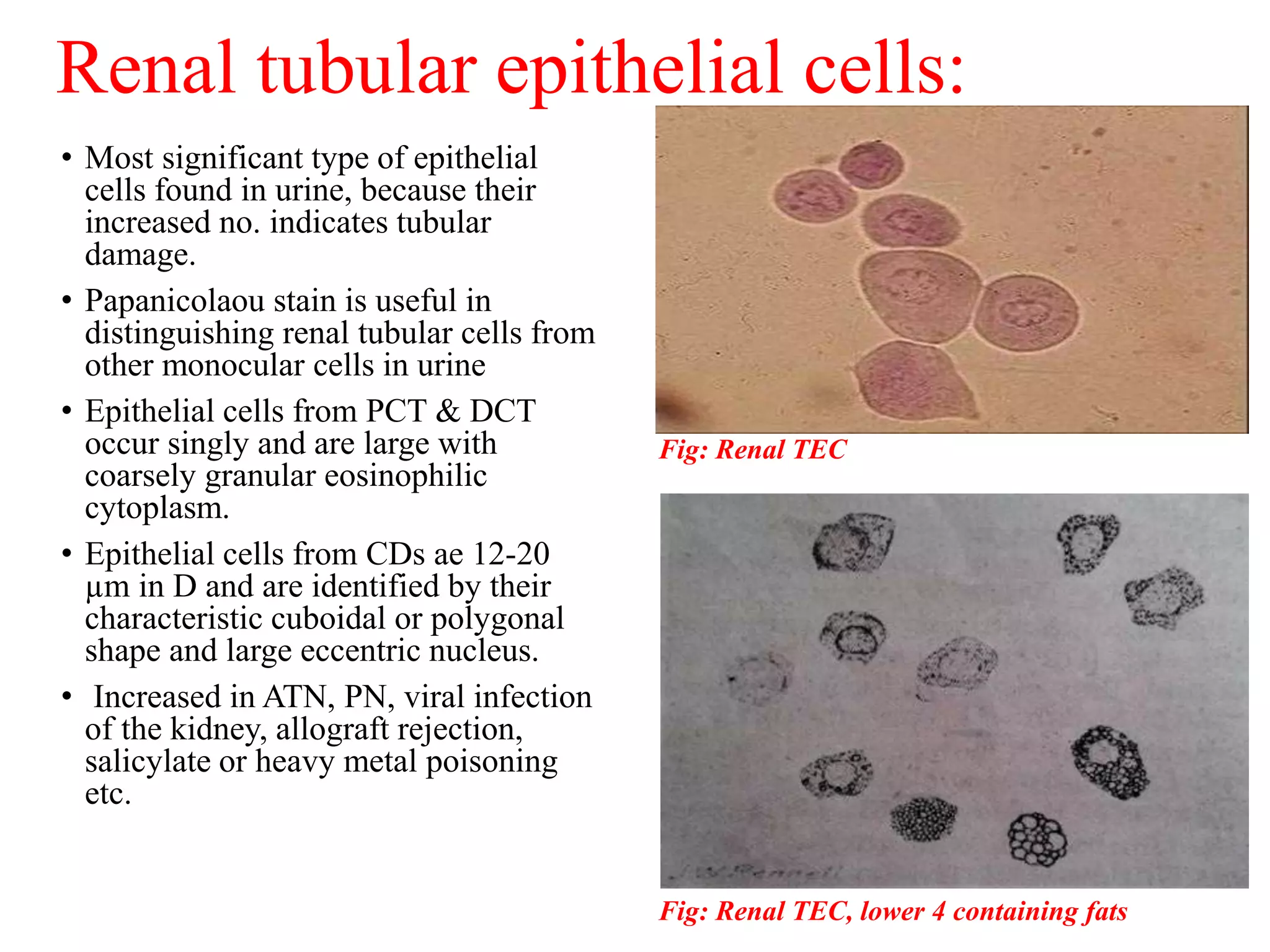 microscopic examination of urine and other special tests | PPTX