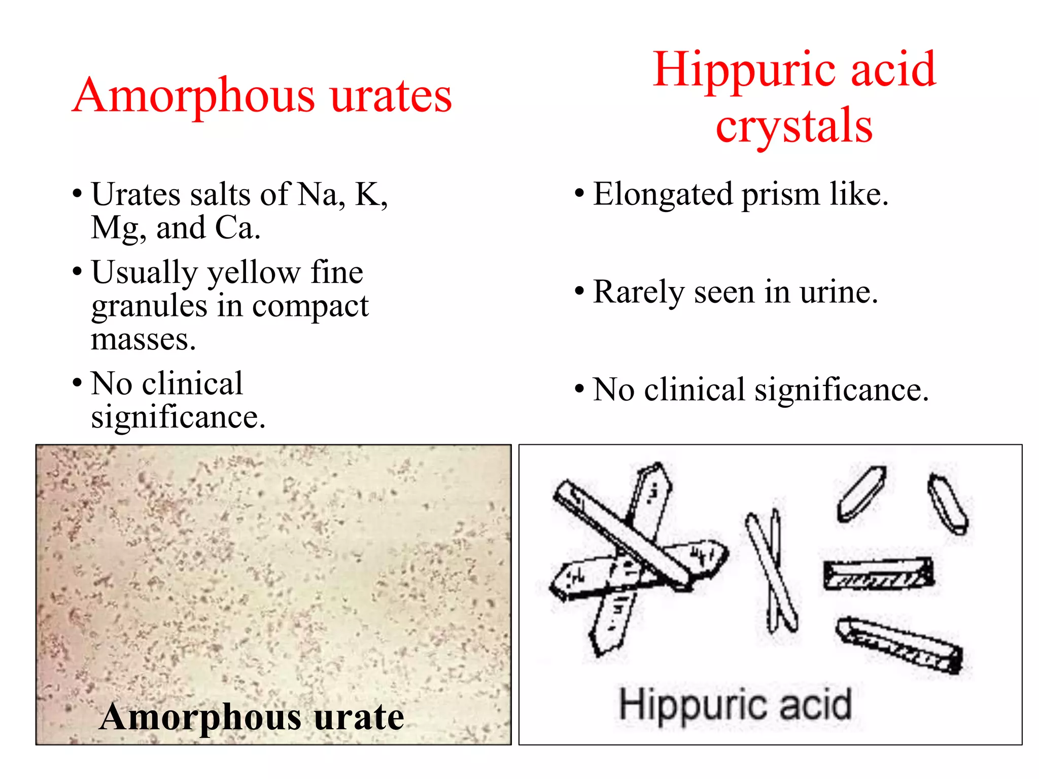 microscopic examination of urine and other special tests | PPTX