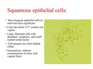 Epithelial Cell In Urine
