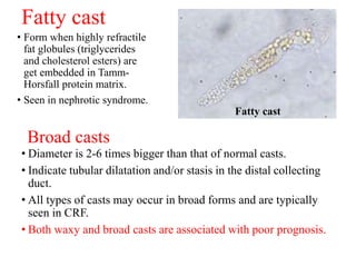 Broad Casts In Urine