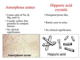 Amorphous Urate Crystals
