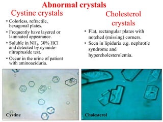 microscopic examination of urine and other special tests | PPT