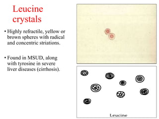 Leucine In Urine