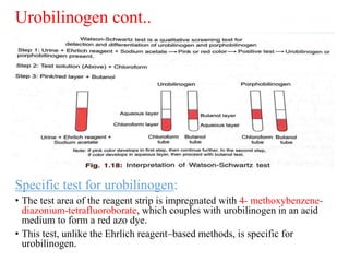 microscopic examination of urine and other special tests | PPT