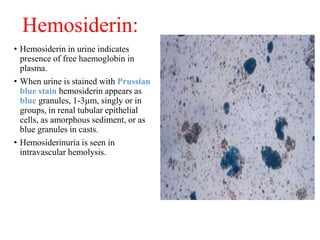 microscopic examination of urine and other special tests | PPT