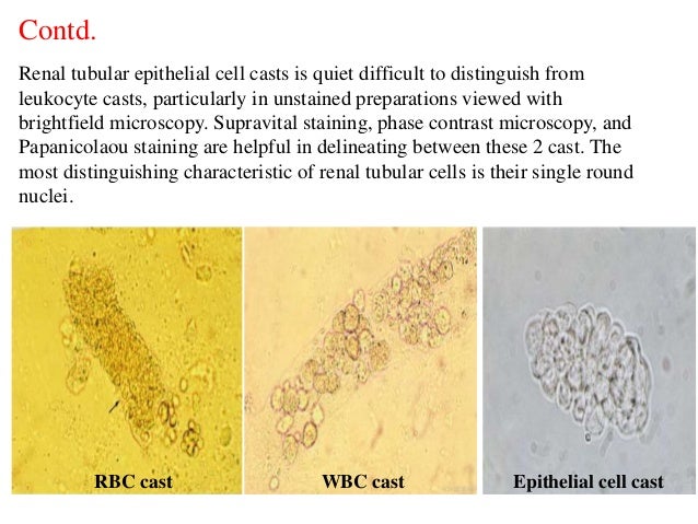 microscopic examination of urine and other special tests