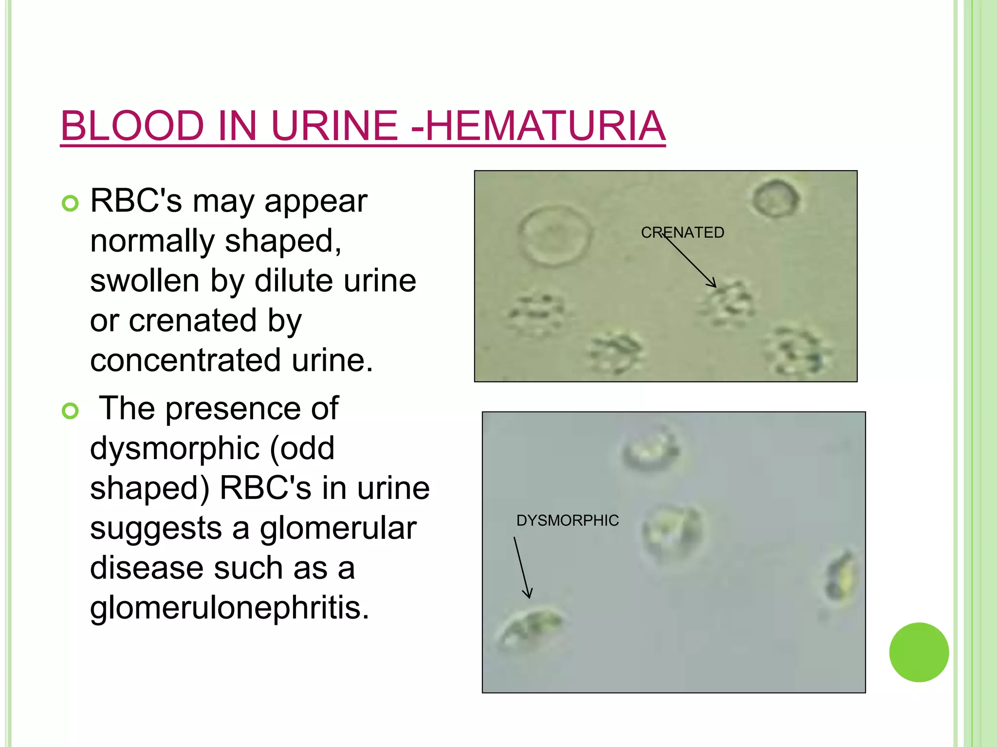 characteristics of urine | PPTX