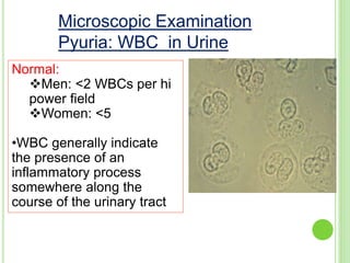 Wbc In Urine