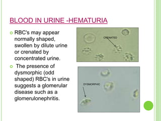 characteristics of urine | PPT