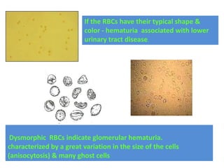 examination of urine (unani) | PPTX
