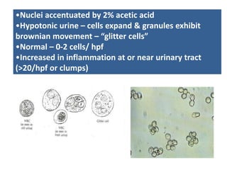 examination of urine (unani) | PPTX