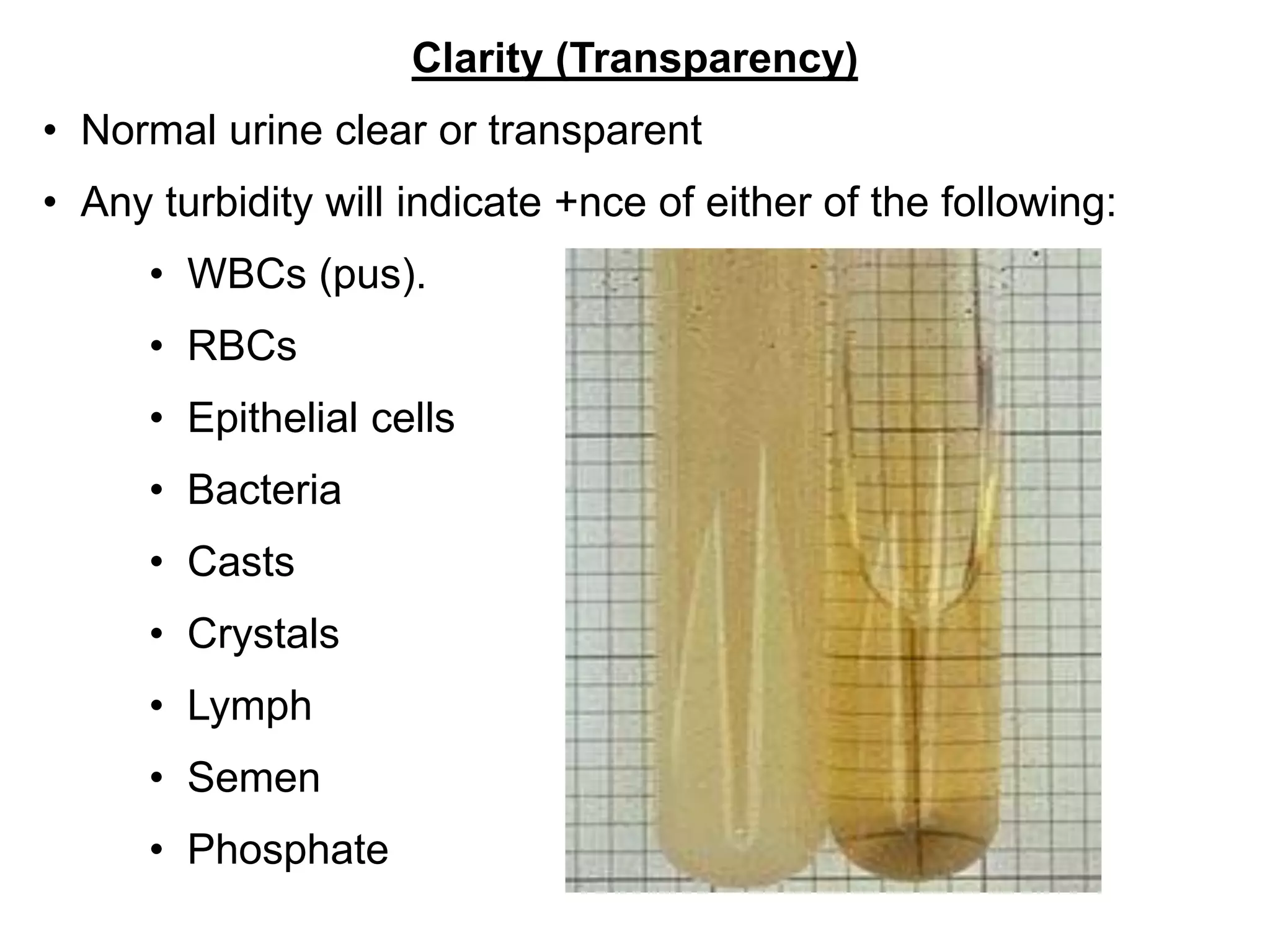"Abnormal Constituents of Urine" practical | PPTX | Endocrine and ...