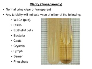 "Abnormal Constituents of Urine" practical | PPTX