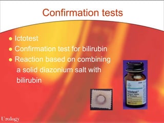 Urine presentation | PPT | Blood Disorders | Diseases and Conditions