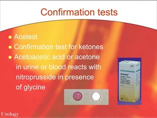 Urine presentation | PPT | Blood Disorders | Diseases and Conditions