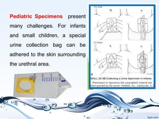 Urine preservative | PPT