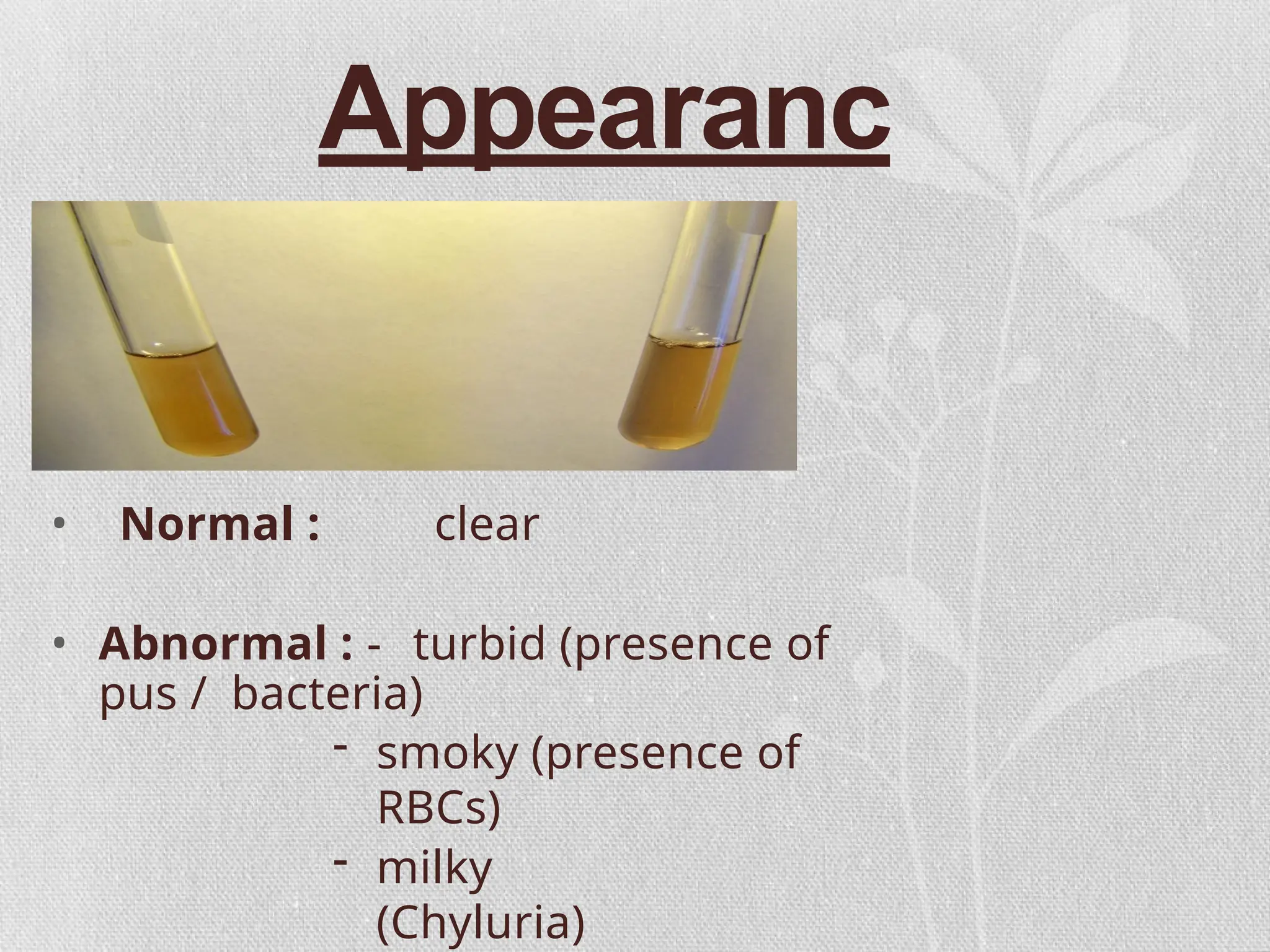 URINE REPORT for MBBS first year Biochem Practical | PPTX