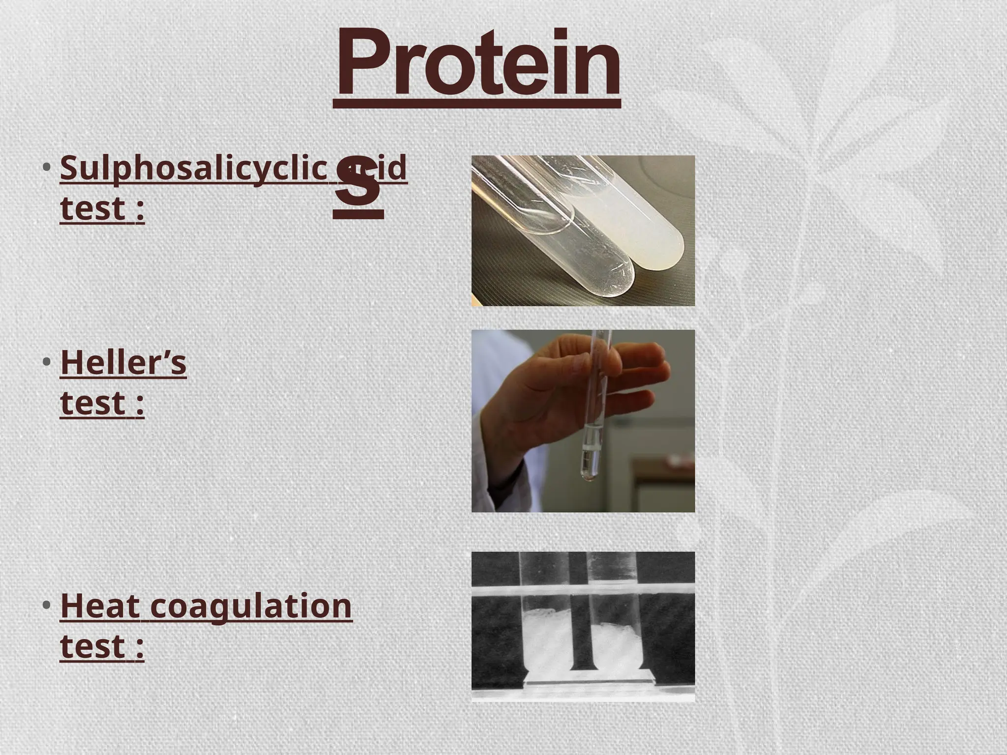 URINE REPORT for MBBS first year Biochem Practical | PPTX